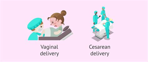 Cesarean Delivery Vs Natural Delivery