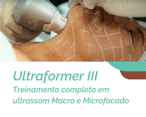 Ultraformer III Treinamento Completo Em Ultrassom Macro E Microfocado