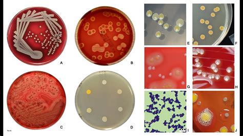 Culture Media In Microbiology Types Of Culture Media And Their Uses