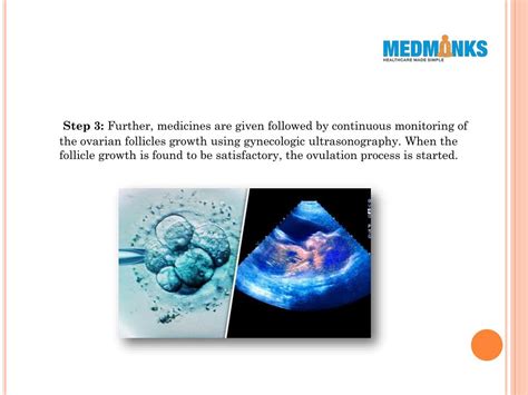 PPT Steps Of IVF Procedure Explained PowerPoint Presentation Free
