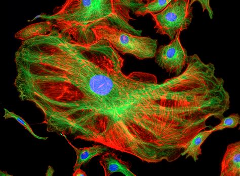Picture Perfect Capturing A High Quality Fluorescent Microscopy Image