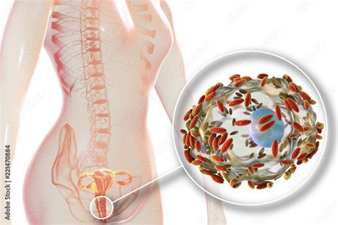 Bacterial Vaginosis Vaginal Secretions Contain Epithelial Cells So