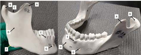 Mandible Diagram Quizlet