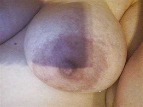 Chrissy Shows Naked Photo 47 113 X3vid