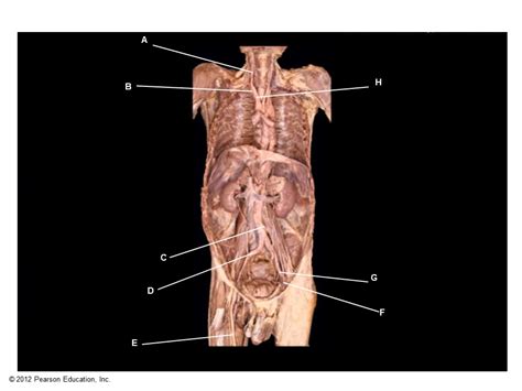Abdominal Cavity Blood Vessels Diagram Quizlet