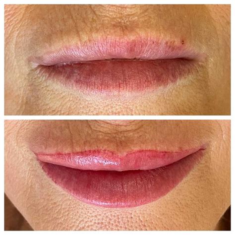 Before After Gallery Of Cosmetic Tattoos Our Service