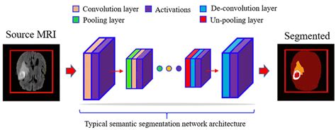 image segmentation in medical imaging