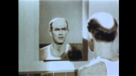 The Medical Aspects Of Nuclear Radiation Hair Loss YouTube