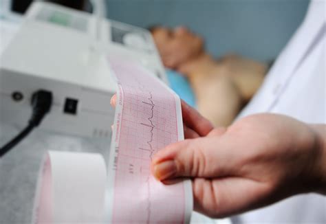 El electrocardiograma prueba sencilla salud del corazón