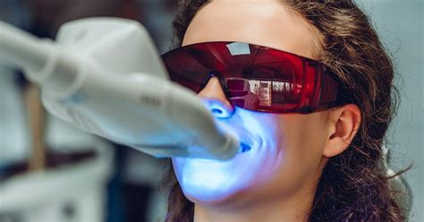 Combien coûte un blanchiment dentaire chez le dentiste