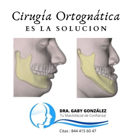 Dra Laura Gabriela Gonz Lez Vald Z Cirujano Maxilofacial Saltillo