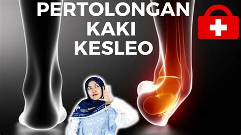 Cara Pertolongan Pertama Kaki Tangan Keseleo Terkilir Cidera YouTube