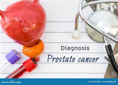 Diagnosis Of Prostate Cancer Medical Concept Picture Of Diagnosis