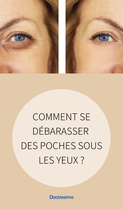 Comment Enlever Les Poches Sous Les Yeux Poches Sous Les Yeux