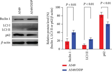 A549 DDP Cells Showed A Higher Level Of Basal Autophagy In Response To