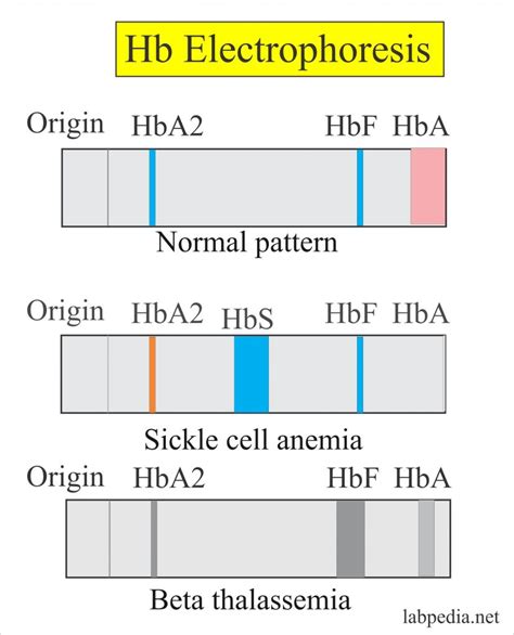 Hemoglobin Part Hemoglobin Electrophoresis Hb Electrophoresis