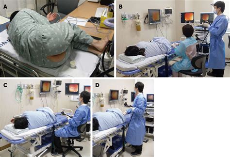 Female Colonoscopy