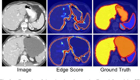 figure 3 from graph based regional feature enhancing for abdominal multi organ segmentation in