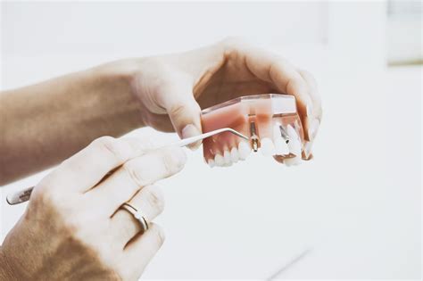 Los problemas más comunes en los implantes dentales Smile Lab