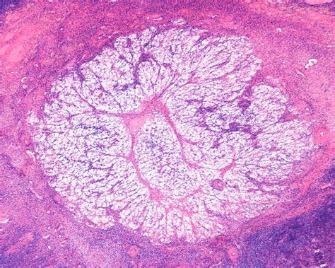 Corpus Albicans Histology