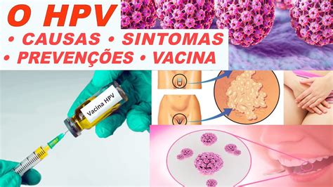 HPV causas sintomas e prevenções YouTube