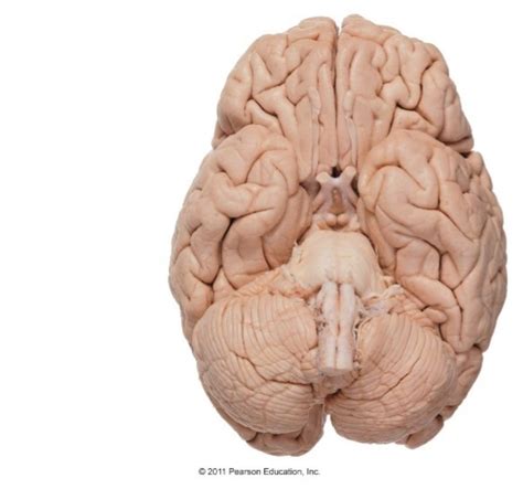 Ventral Aspect Of Brain Diagram Quizlet