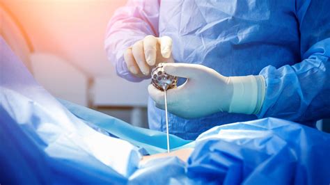 Ead Medic Cirurgia Endosc Pica Da Coluna Vertebral X Cirurgia Tradicional