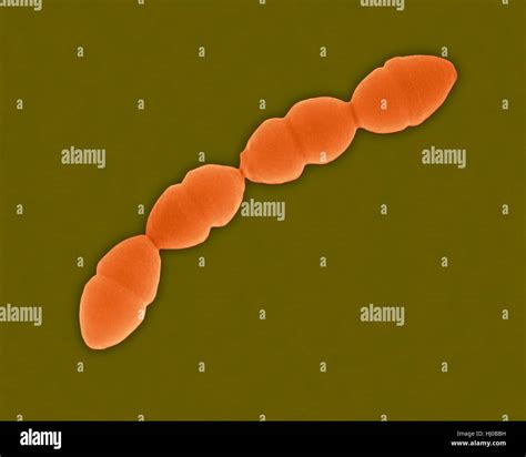 Coloured Scanning Electron Micrograph SEM Of Streptococcus Pneumoniae