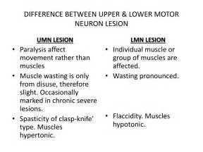 Upper Vs Lower Motor Neuron Signs