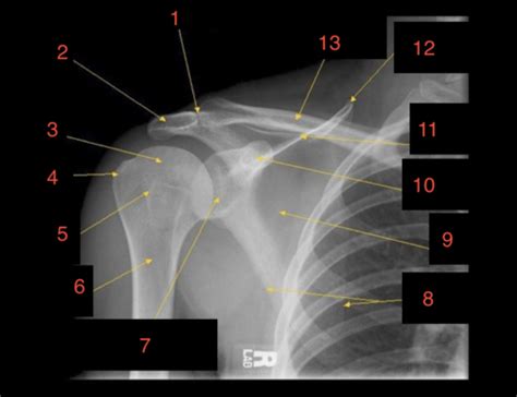 Upper Extremity Flashcards Quizlet