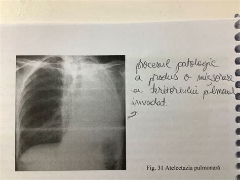 Radiologie Flashcards Quizlet
