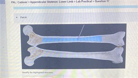 Solved Pal Cadaver Appendicular Skeleton Pelvic Girdle Chegg