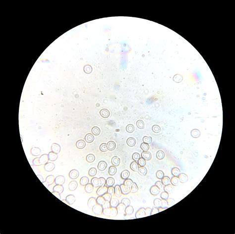 Under The Microscope Blood Office For Science And Society Mcgill