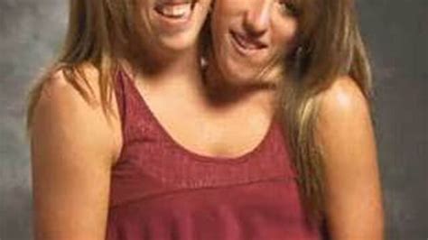 15 choses que vous ignorez sur les célèbres soeurs siamoises Abby et