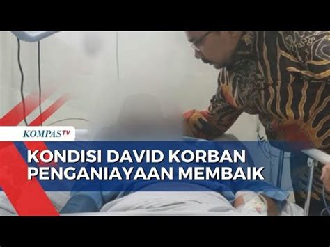 Kondisi David Korban Dianiaya Mario Dandy Mulai Membaik YouTube