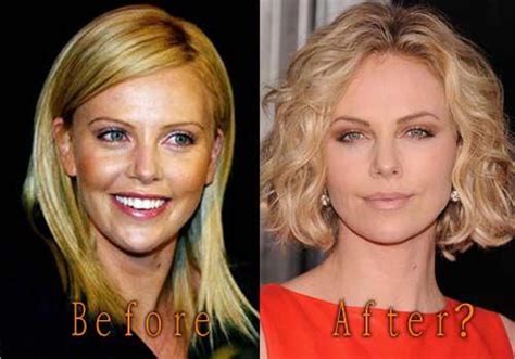Charlize Theron Plastic Surgery Before After Photos Charlizetheron
