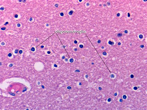Oligodendrocyte Histology