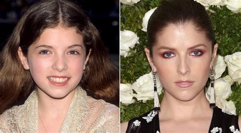 Anna Kendrick Nose Job Before And After