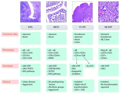 T Cell And Nk Cell Neoplasms Of The Gastrointestinal Tract Recurrent