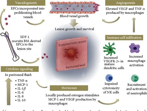 Figure 1 From Pathophysiology And Immune Dysfunction In Endometriosis