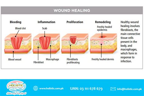 Wounds Healing Tips For Caregivers And Nurses Call At 03 111 678 679