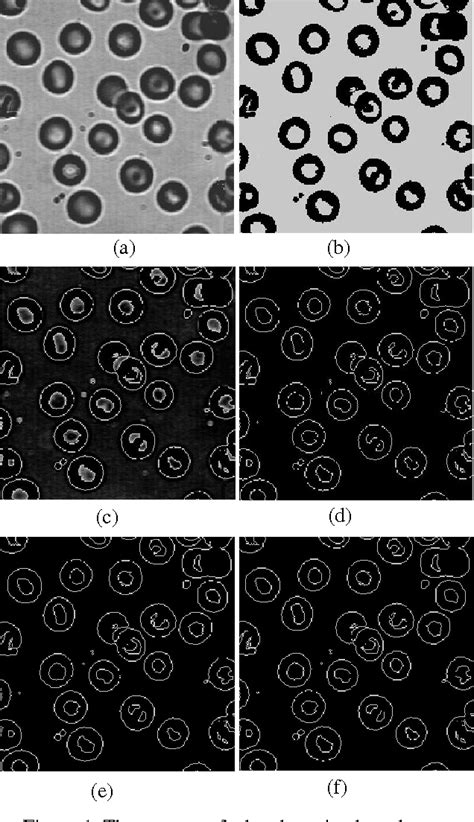 figure 1 from method of edge detection based on non linear cellular automata semantic scholar