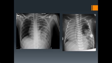 Abdominal Trauma And Gi Emergencies Flashcards Quizlet