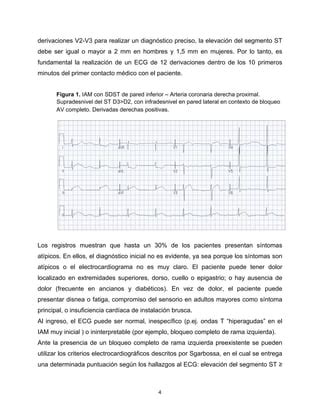 Infarto Agudo Al Miocardio Con Elevaci N Del Segmento St Y Terapias De