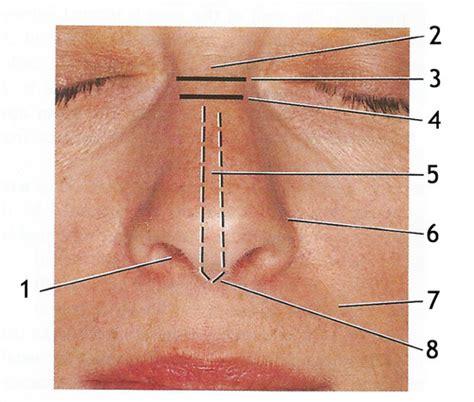 Nose Sinuses Mouth And Throat Flashcards Quizlet