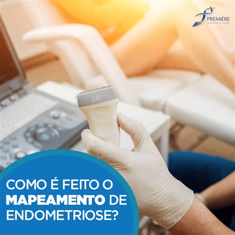 Como Feito O Exame De Mapeamento De Endometriose Premi Re Medicina