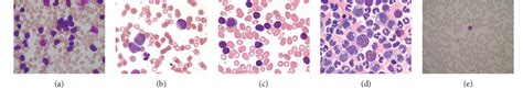 [pdf] iomt based automated detection and classification of leukemia using deep learning