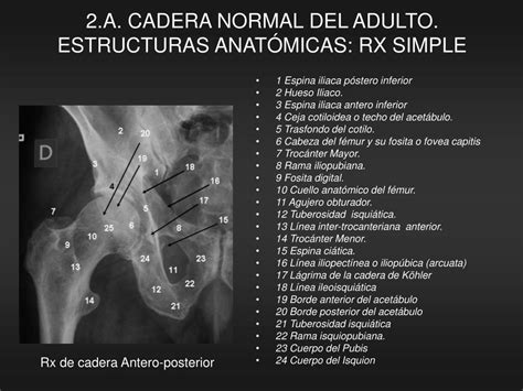 PPT ANATOMÍA RADIOLÓGICA DE LA CADERA ESTAMOS LOS RADIÓLOGOS