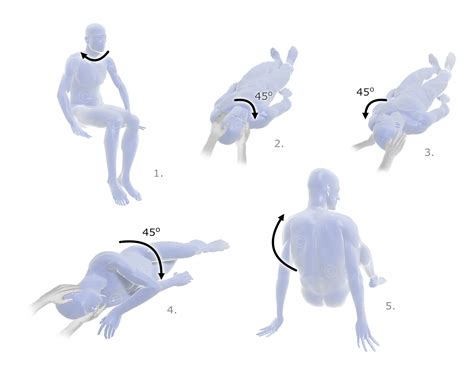 Illustration Epley Maneuver Medicalgraphics