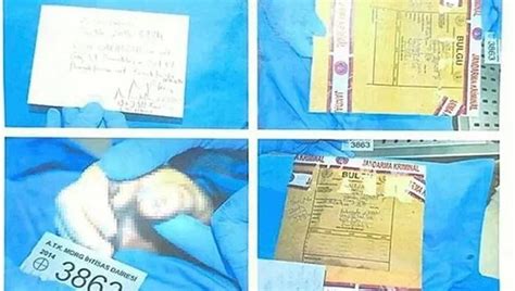 Cem Garipoğlu nun elindeki mor lekelerin sırrı belli oldu
